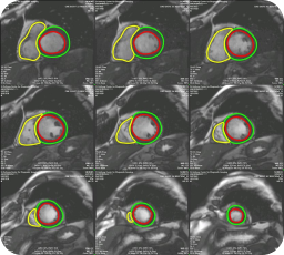 Specialized CT and MR Image Post-Processing Solutions | PIA Medical